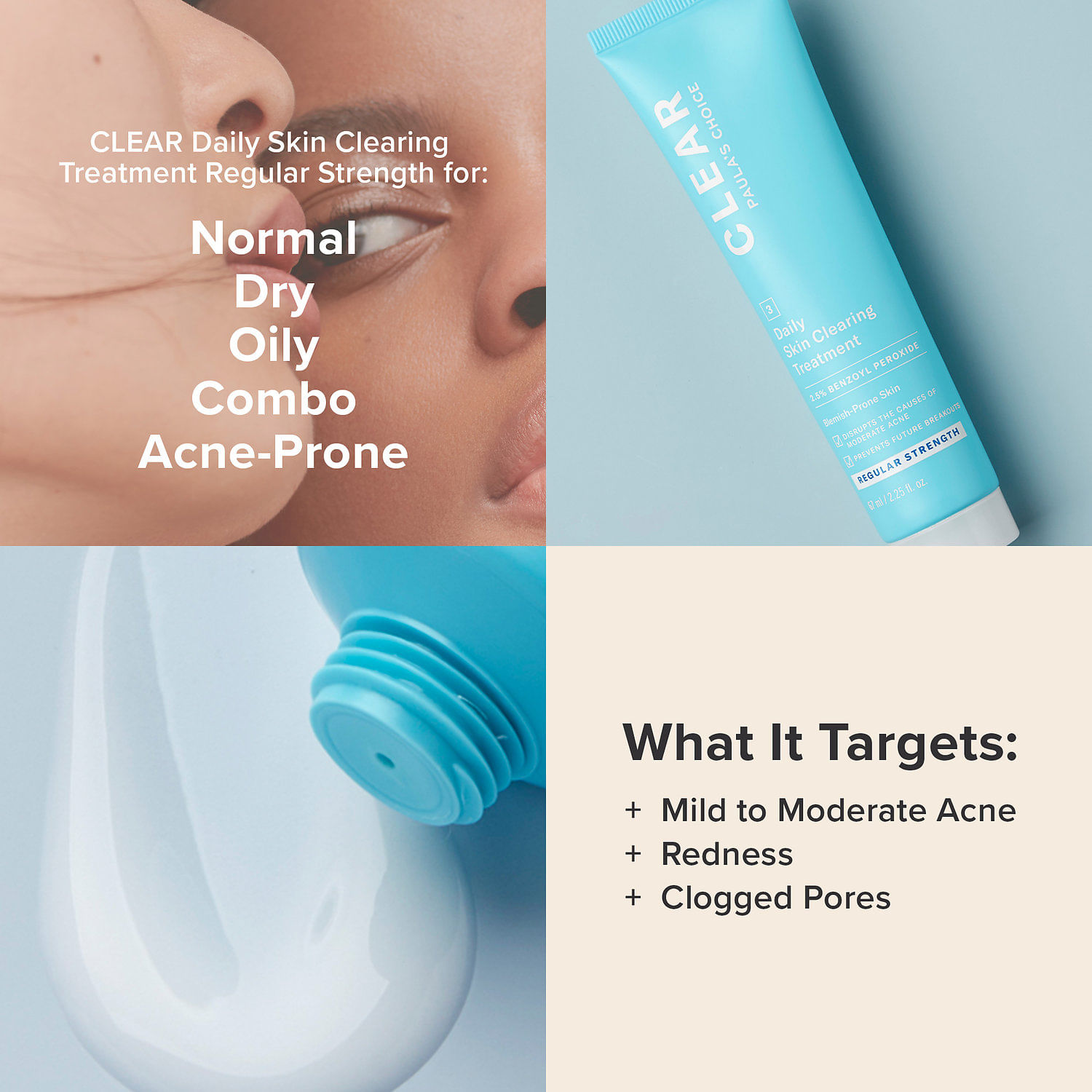 Clear Daily Skin Clearing Treatment With 2.5% Benzoyl Peroxide | Women ...