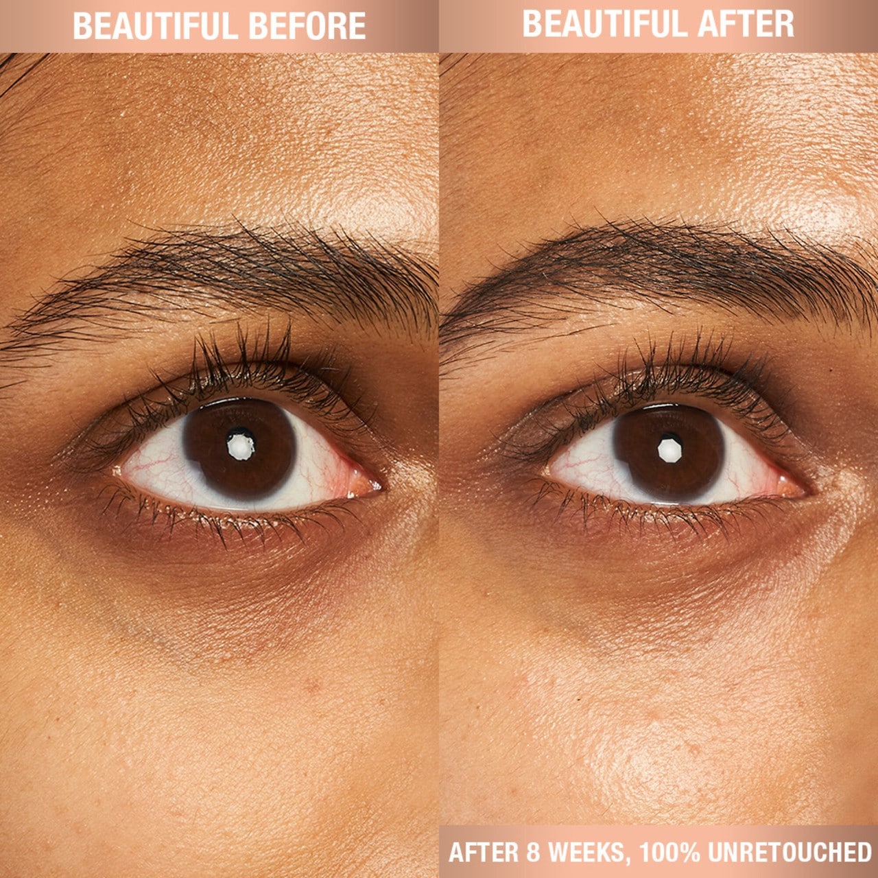 Charlotte’s Magic Eye Cream With Retinol | Women's Health Shop